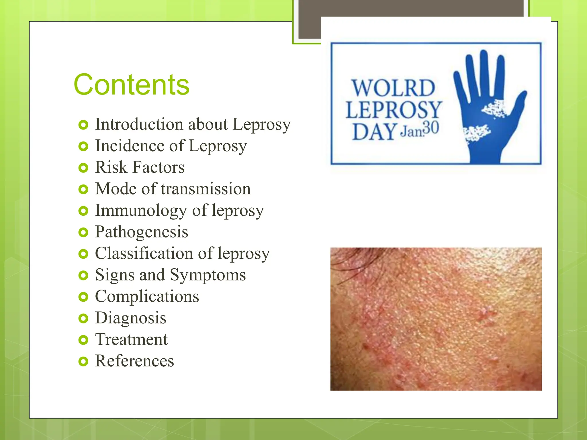 Leprosy Department of Physiotherapy, SHUATS, Prayagraj | PPTX