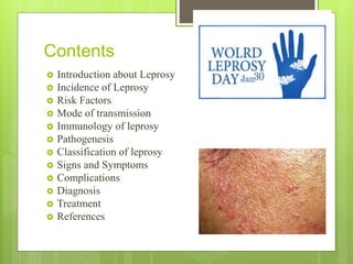 Leprosy Department of Physiotherapy, SHUATS, Prayagraj | PPTX