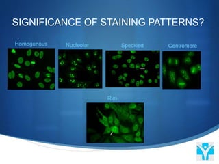 ANA testing myths and pittfalls | PPTX