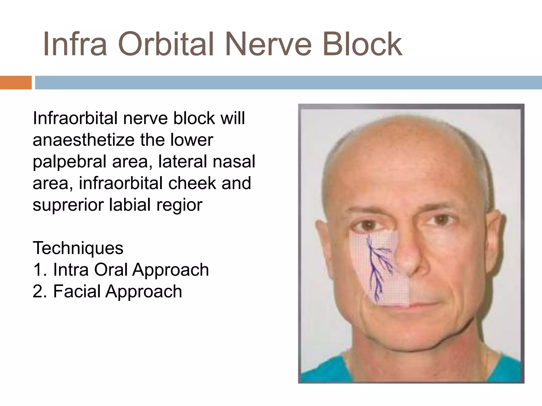 Local Anaesthesia In Plastic Surgery | PPTX