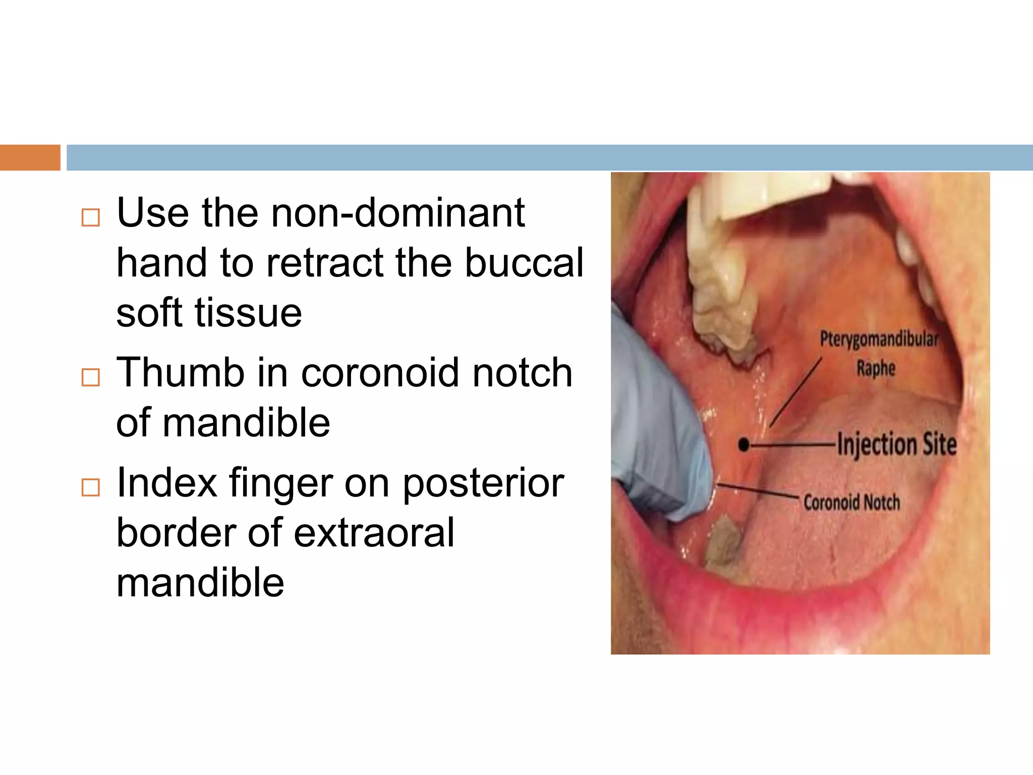 Local Anaesthesia In Plastic Surgery | PPTX