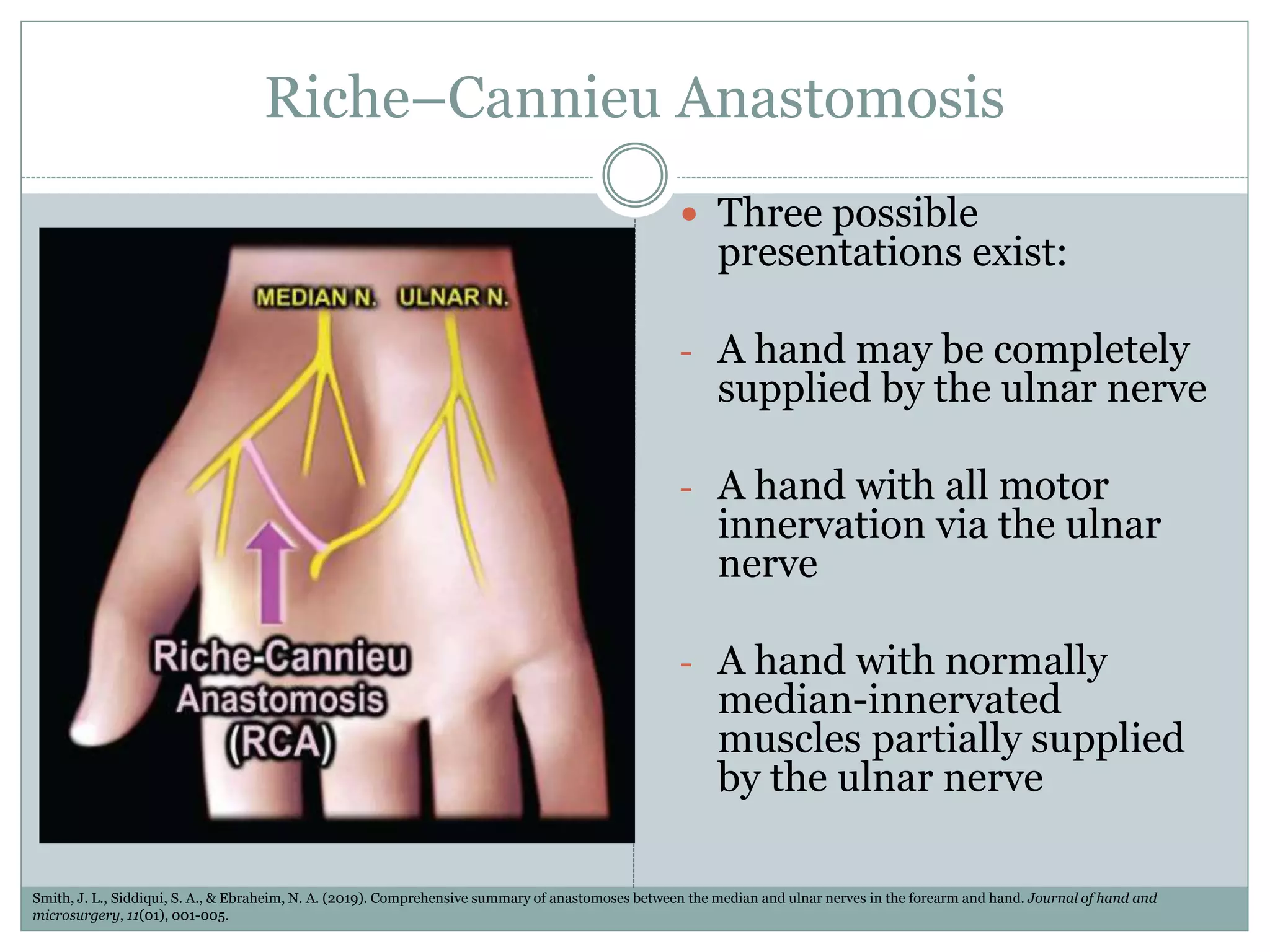 Anastomosis between Median and Ulnar Nerve in The Forearm and Hand | PPTX