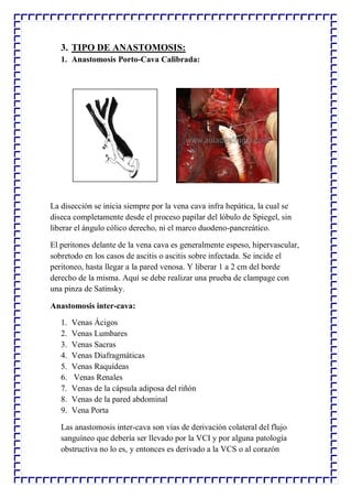 Anastomosis de la pórta cava | PDF