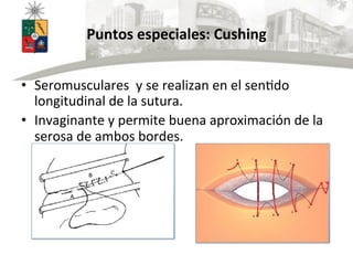 Anastomosis intestinales | PDF
