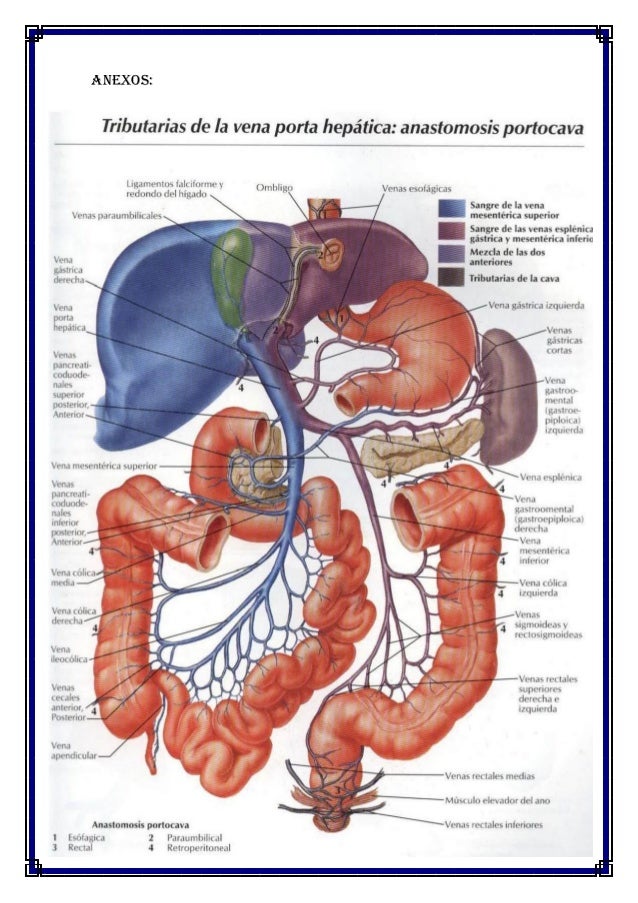 Anastomosis porto cava