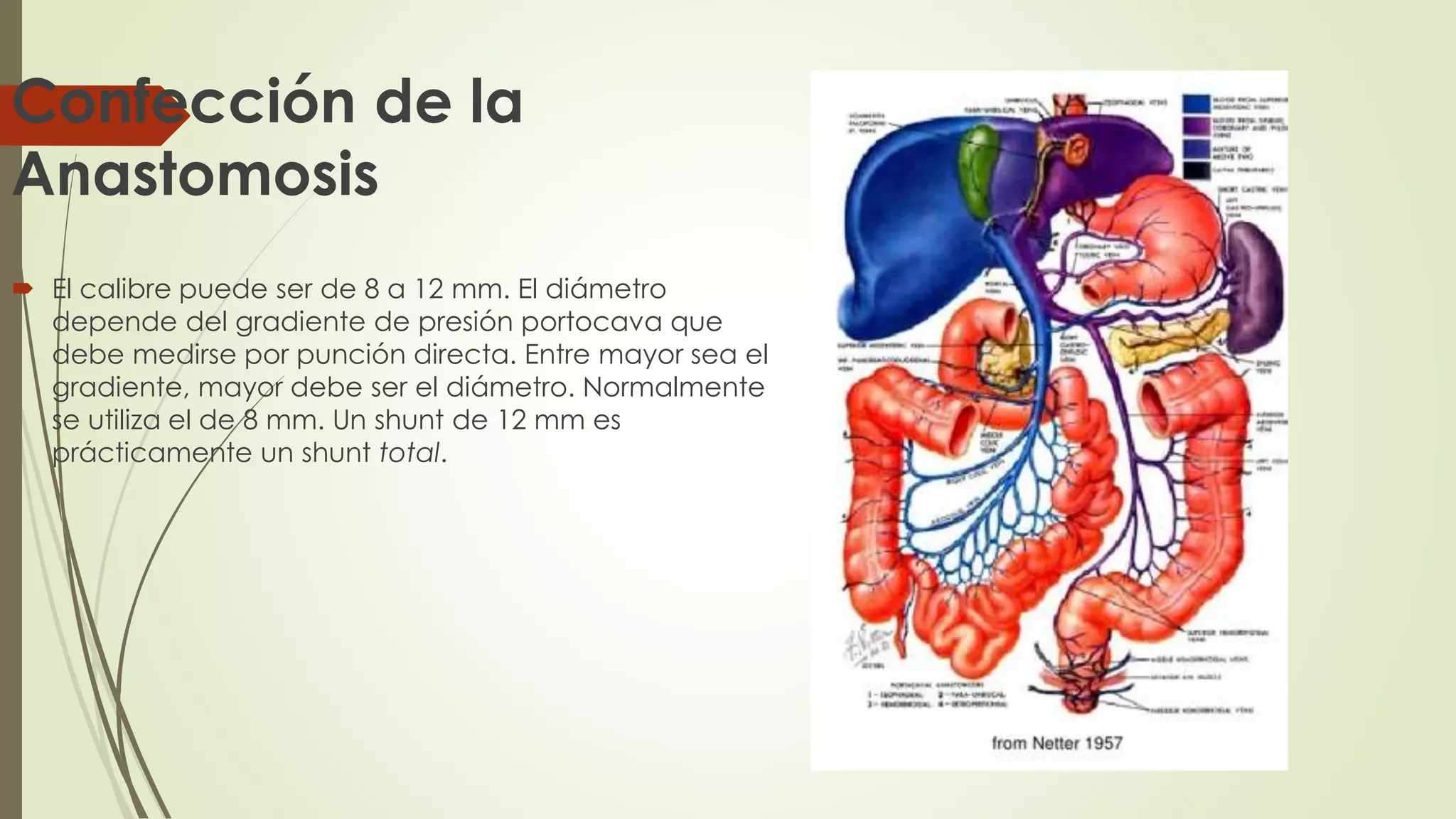 Anastomosis porto cava | PPTX