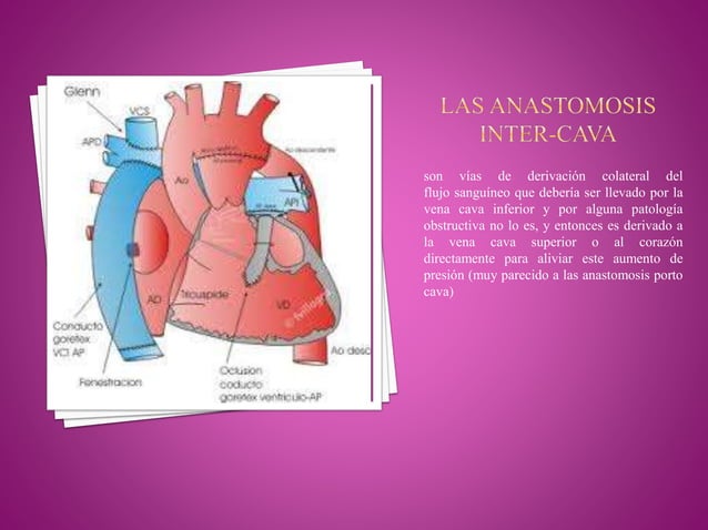 Anastomosis ; su clasificación , sus funciones | PPTX