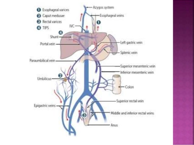 ANASTOMOSIS PORTO CAVA
