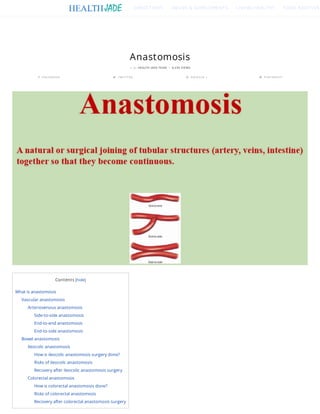 Anastomosis surgery | PDF