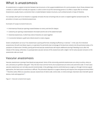 Anastomosis surgery | PDF