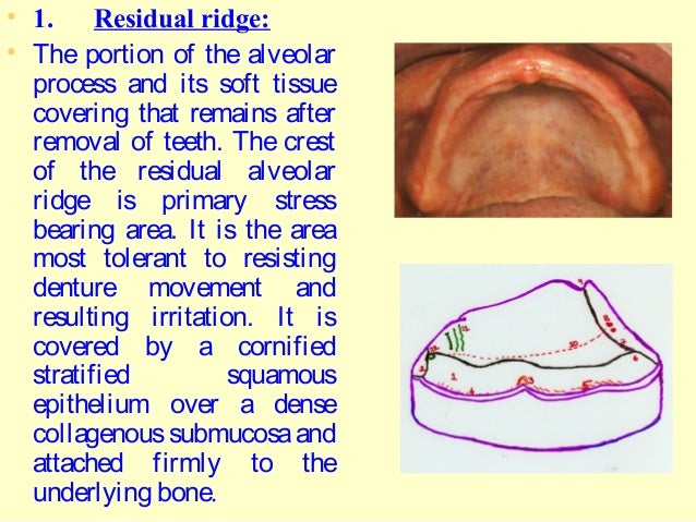 Anatomical landmarks of maxilla / dental implant courses