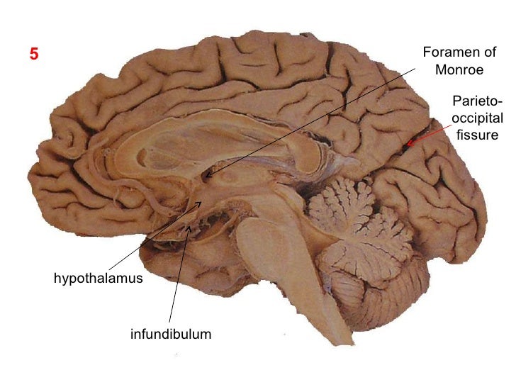 Infundibulum Brain Cerebellum