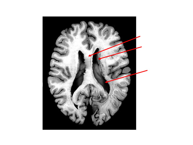 Anat 321lab4 2009 Fillintheblank | PPT