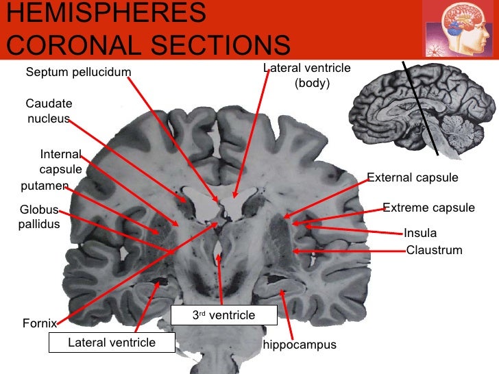 ANAT-321: review lab 3 & 4