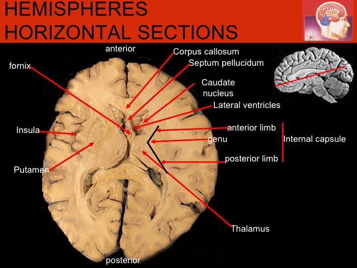 Vestibular Anterior Fornix