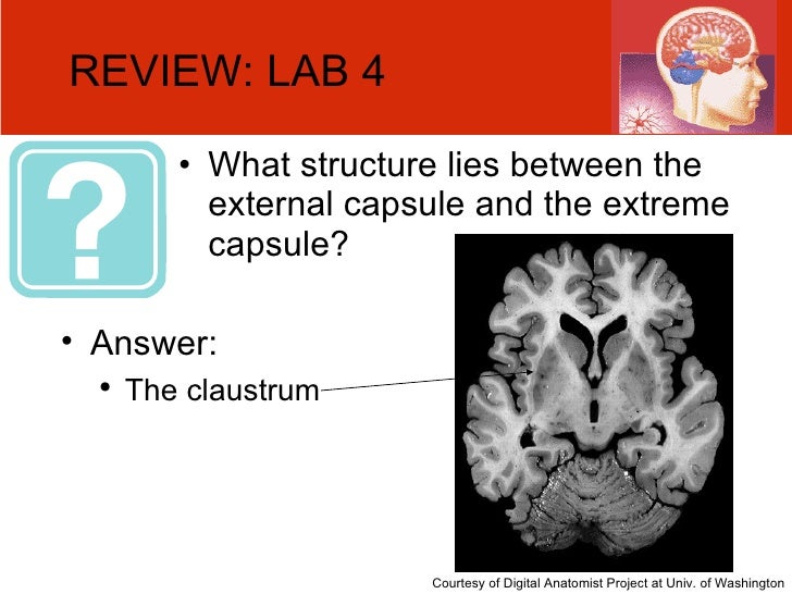 Anat321demoreview Lab 4 2009