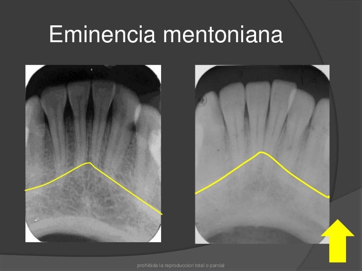 Anatamia normal en_tecnicasperiapicales (1)