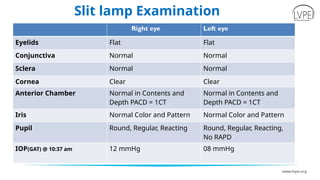 anatomy of retina about it and explanation.pptx