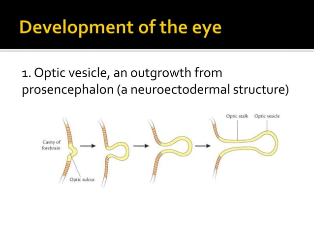 Anatomy and Development of eye.pptx