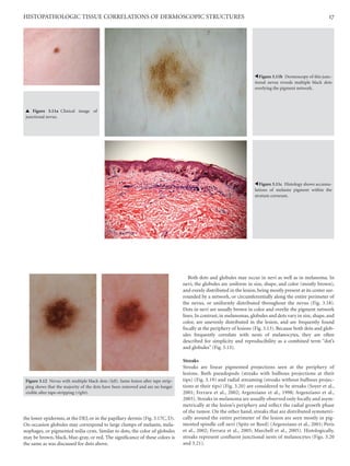 An Atlas of Dermoscopy, Second Edition ( PDFDrive ).pdf