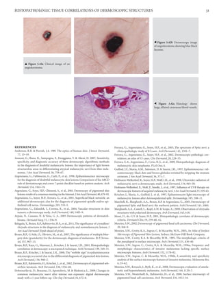 An Atlas of Dermoscopy, Second Edition ( PDFDrive ).pdf