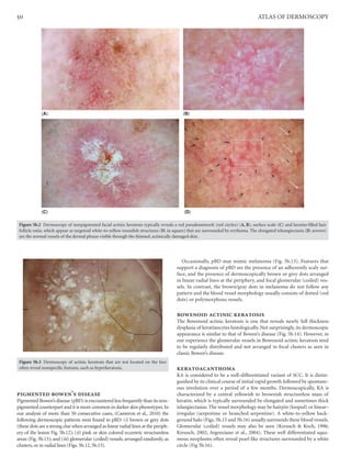 An Atlas of Dermoscopy, Second Edition ( PDFDrive ).pdf