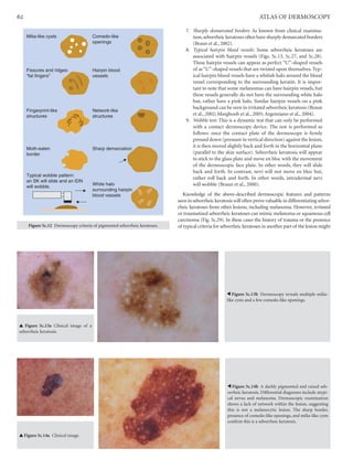 An Atlas of Dermoscopy, Second Edition ( PDFDrive ).pdf