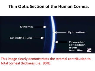 Anat n physio of cornea......... arya | PPT
