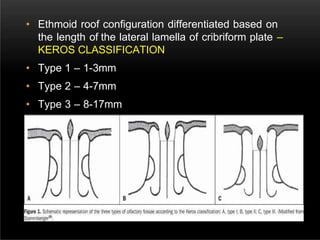 ANATOMICAL DETAILS OF THE ETHMOID BONE.pptx