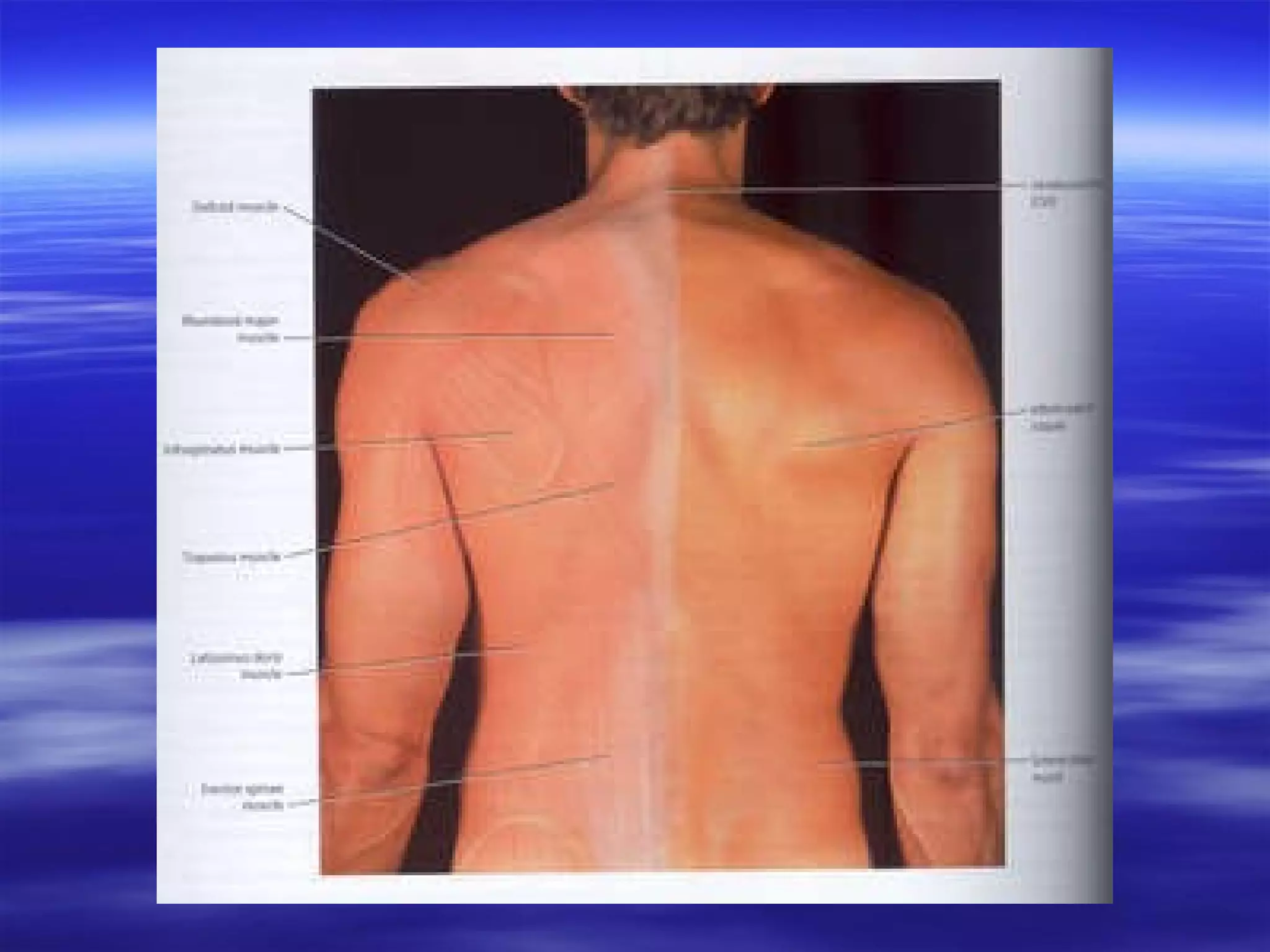 AnatomíA De Superficie Del TóRax LíNeas Del TóRax | PPT