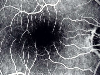 Anatomía basica de la retina | PPT