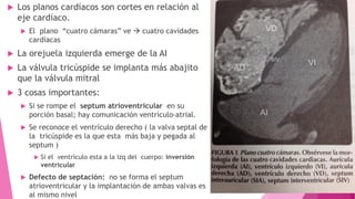 Anatomía cardiovascular por imagen | PDF