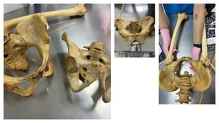 Anatomía clínica DE PELVIS Y MUSCULOS PELVICOS.pptx