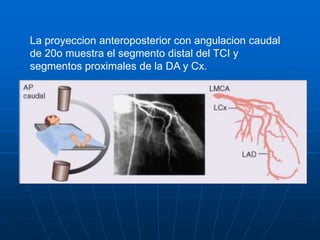 Anatomía coronaria | PPTX