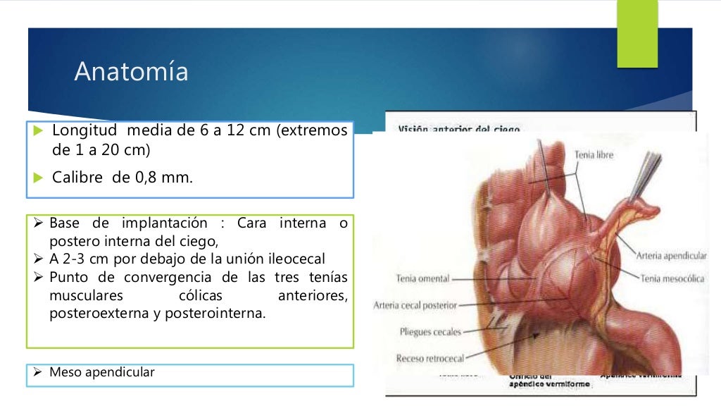 Anatomía Del Apéndice | Apendicitis – QUPK