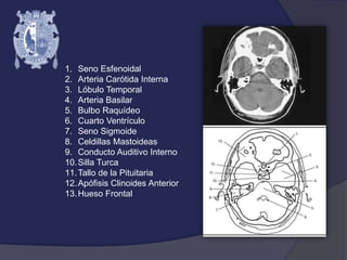 Anatomía Tomográfica de Cráneo | PPTX
