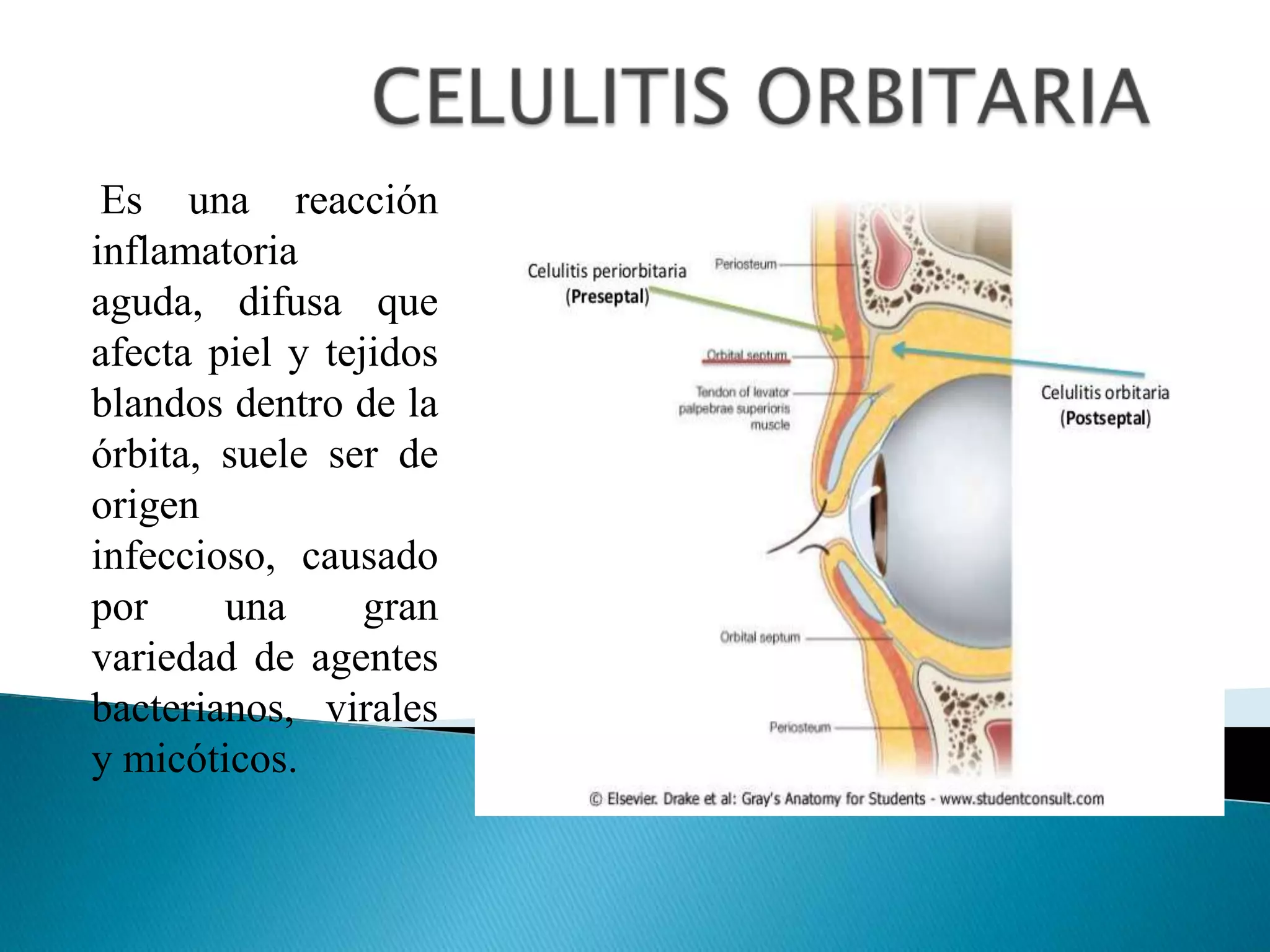 Anatomía de la orbita, celulitis preseptal, celulitis orbitaria y ...