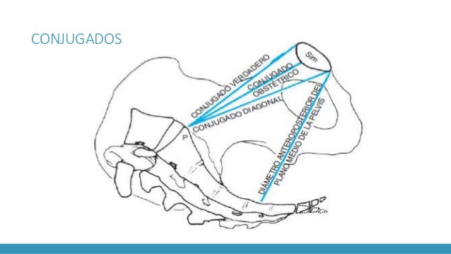Anatomía de la pelvis femenina (Obstetricia)