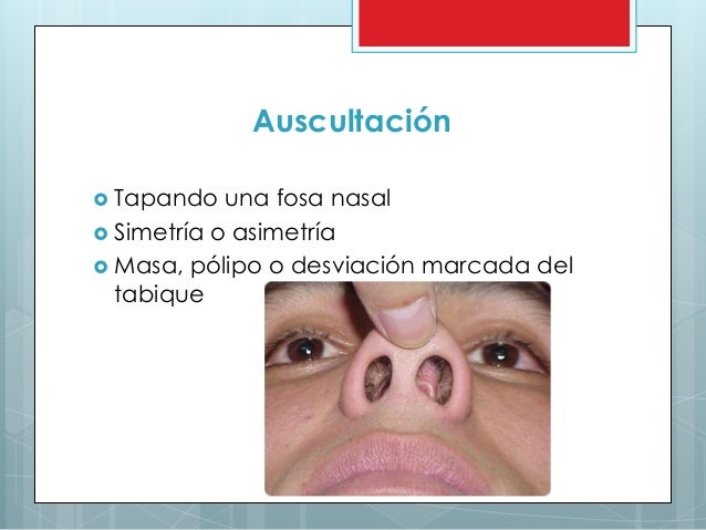 Anatomía de las fosas nasales y los senos paranasales