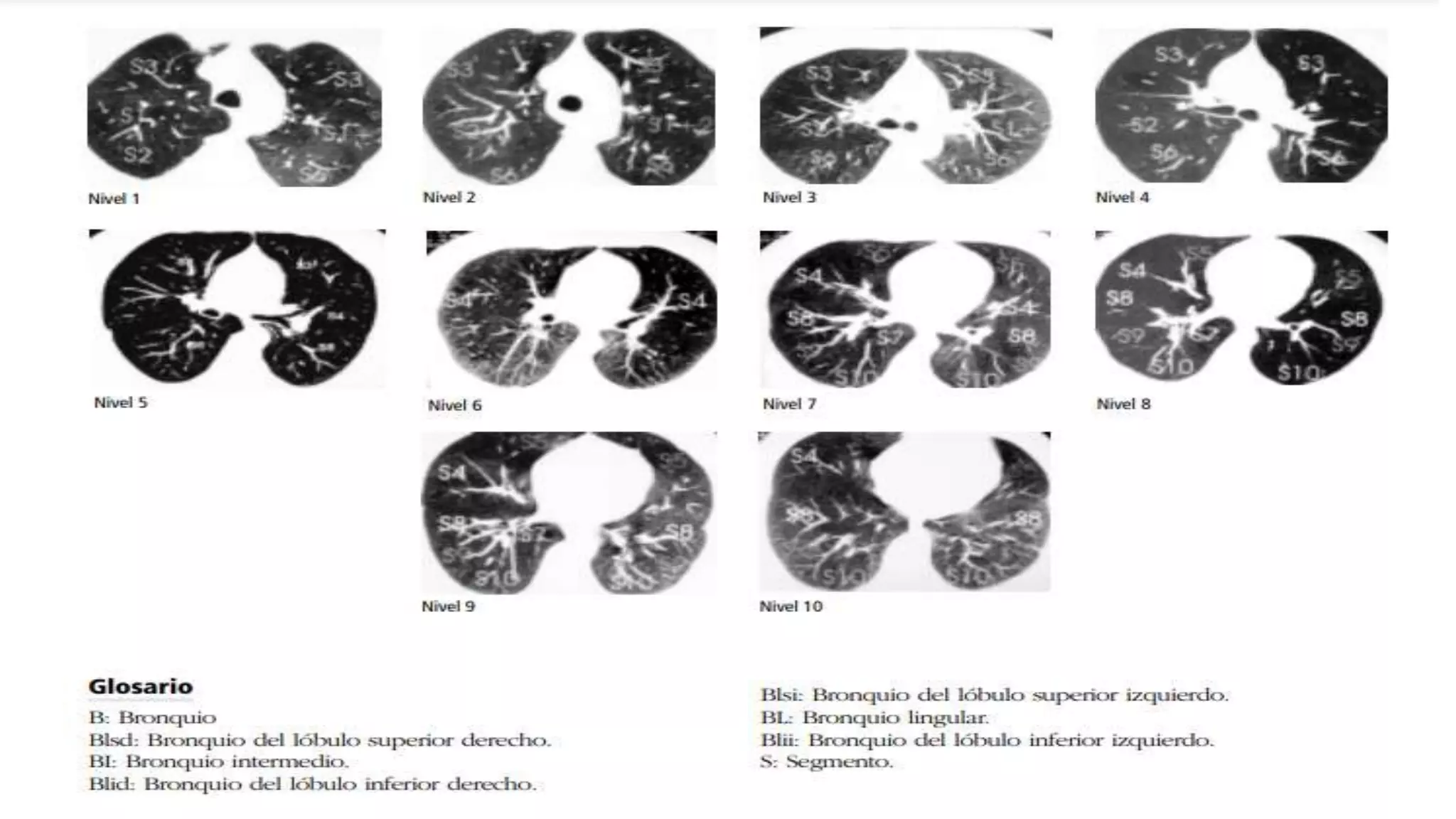 ANATOMÍA DE LA VIA AÉREA Y CAJA TORÁCICA | PPTX