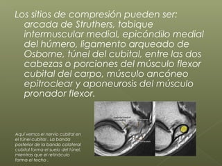 Anatomía del codo por resonancia | PPT