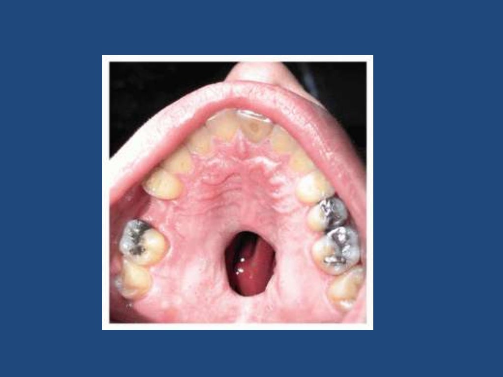 Anatomía del paladar