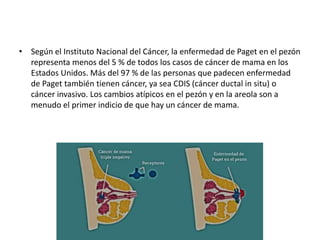 Anatomía de mama.ppt