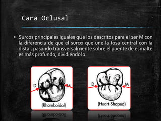 Anatomía dental de los molares superiores | PPTX