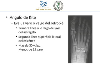 Anatomía de pie y radiologia del pie ppt | PPTX