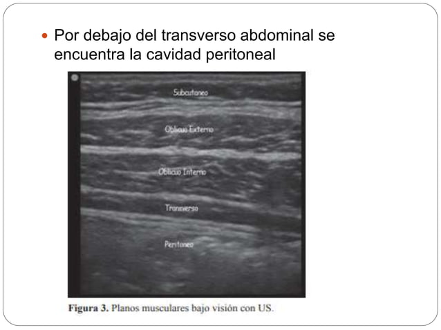 Anatomía de plano transverso abdominal.pptx