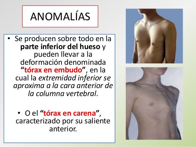 Anatomía de tórax (ANATOMÍA DE TÓRAX)