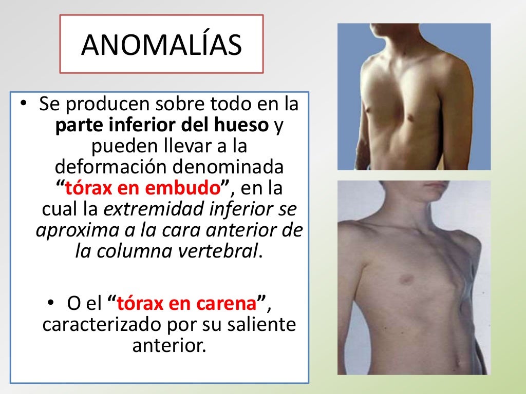 Anatomía de tórax (ANATOMÍA DE TÓRAX)