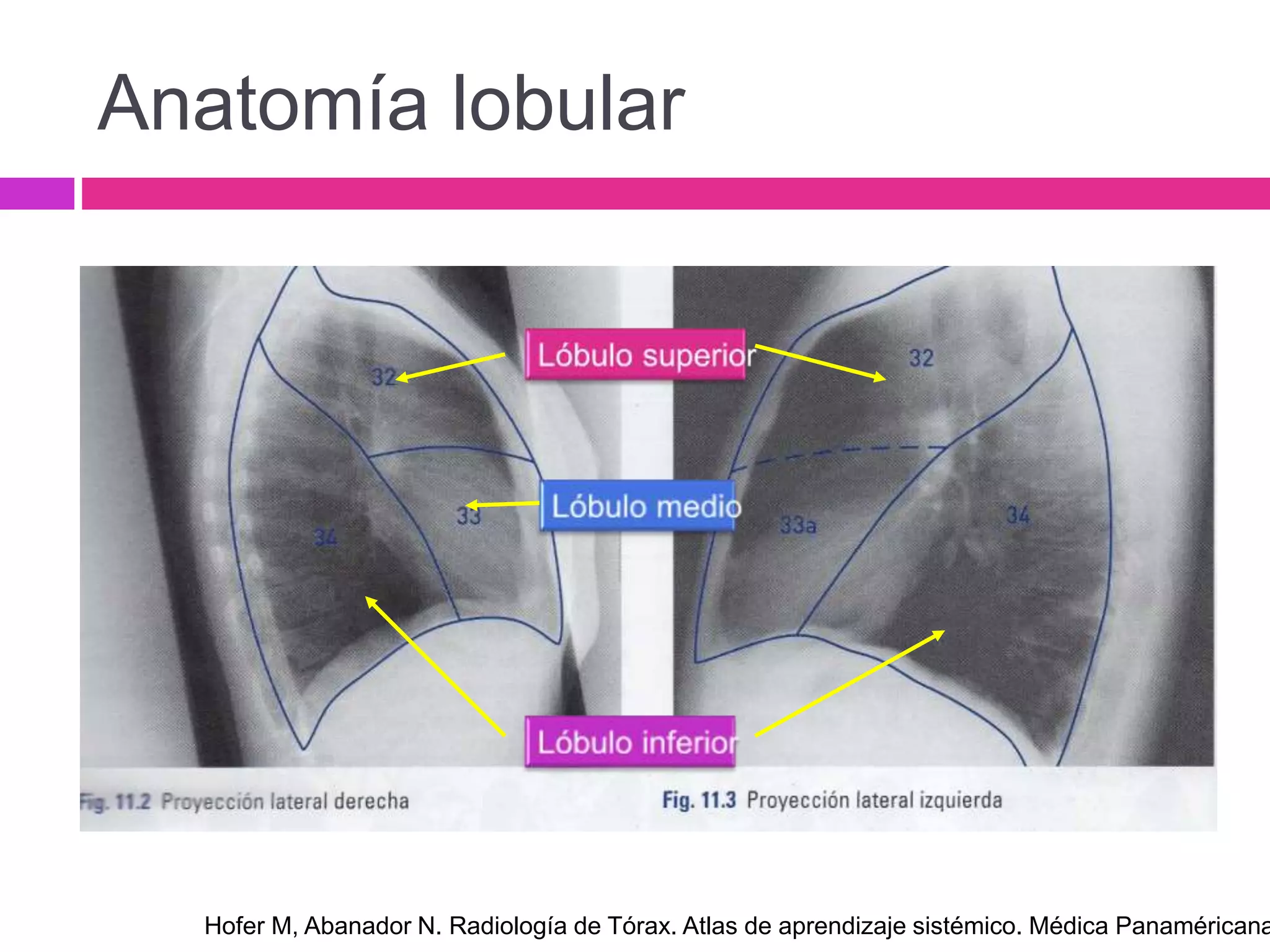 Anatomía de tórax y radiología de tórax normal | PPT