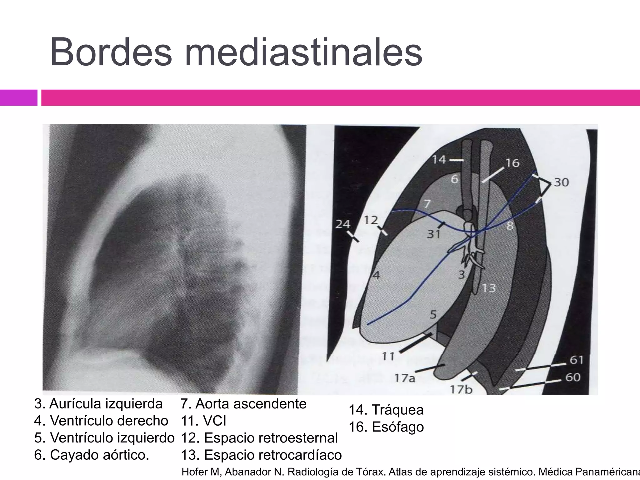 Anatomía de tórax y radiología de tórax normal | PPTX